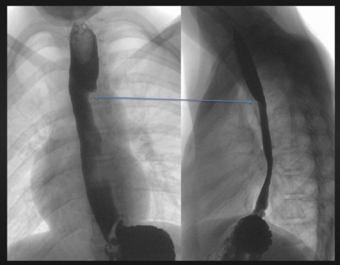 Fluoroscopy – Lakes Radiology