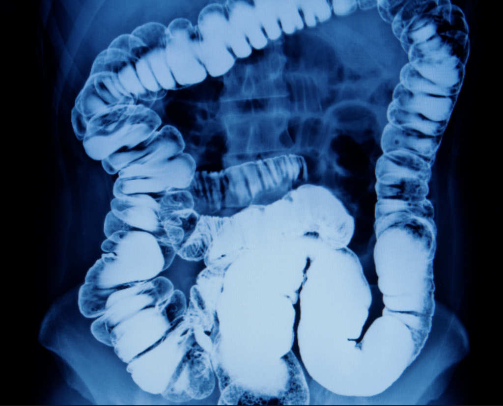 Fluoroscopy – Lakes Radiology